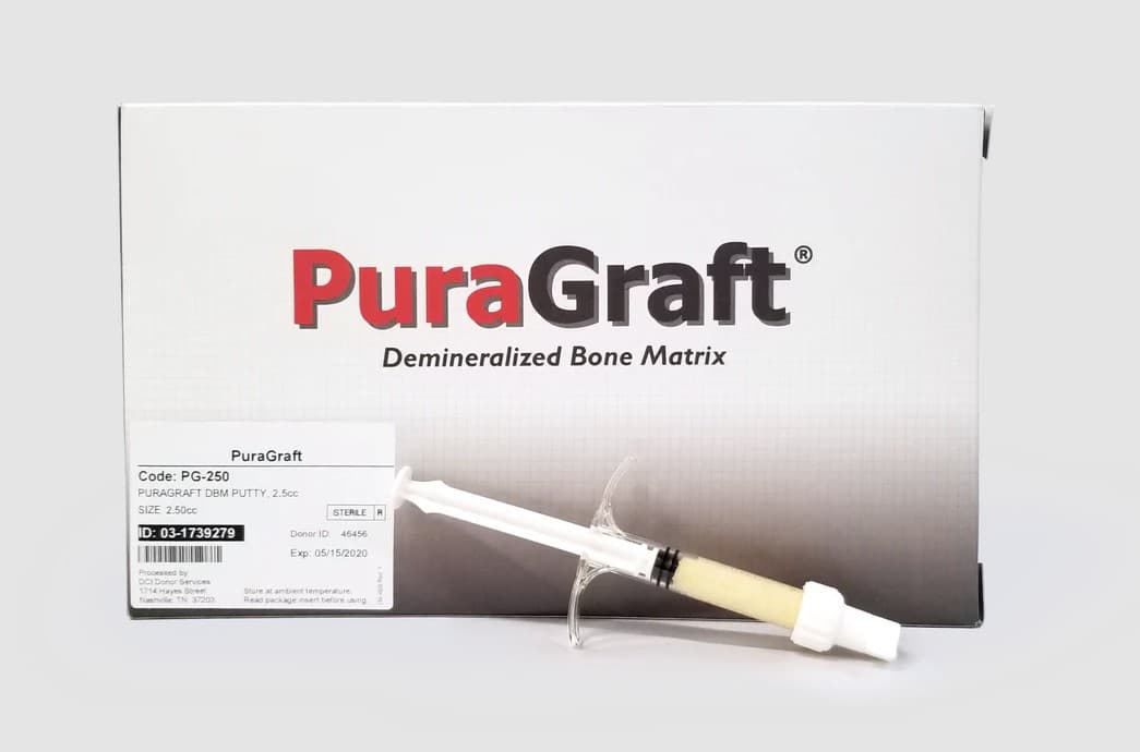DBM Allograft Putty Syringe
