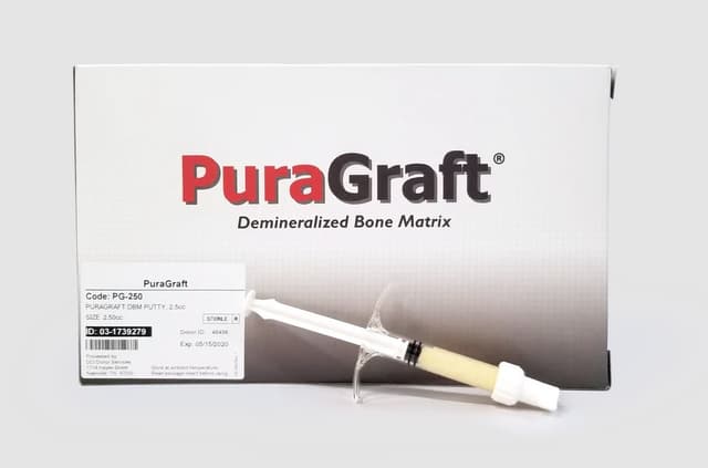 DBM Allograft Putty Syringe 1cc